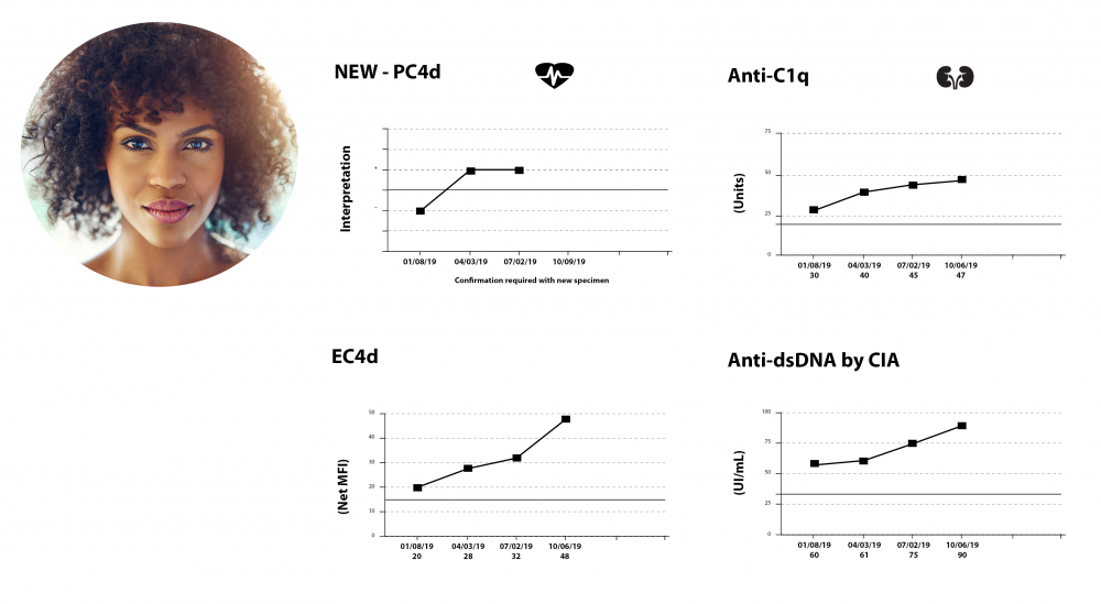 Lupus Diagnosis and Management: 3 Tests That May be Right for You ...