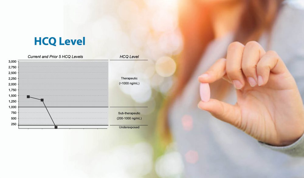 Lupus Diagnosis and Management: 3 Tests That May be Right for You ...